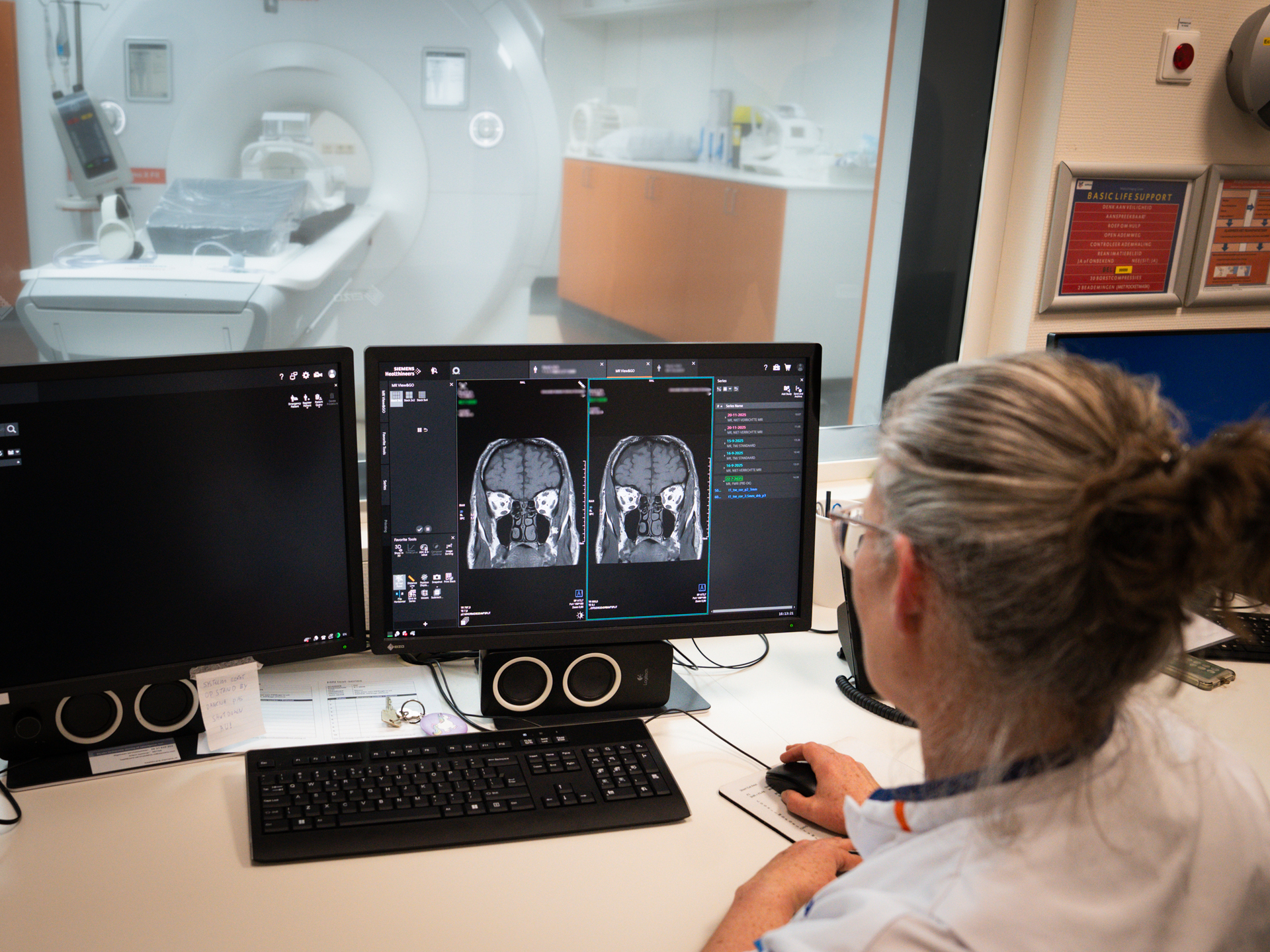 Diagnoses sneller en nauwkeuriger met nieuwe MRI-scanner
