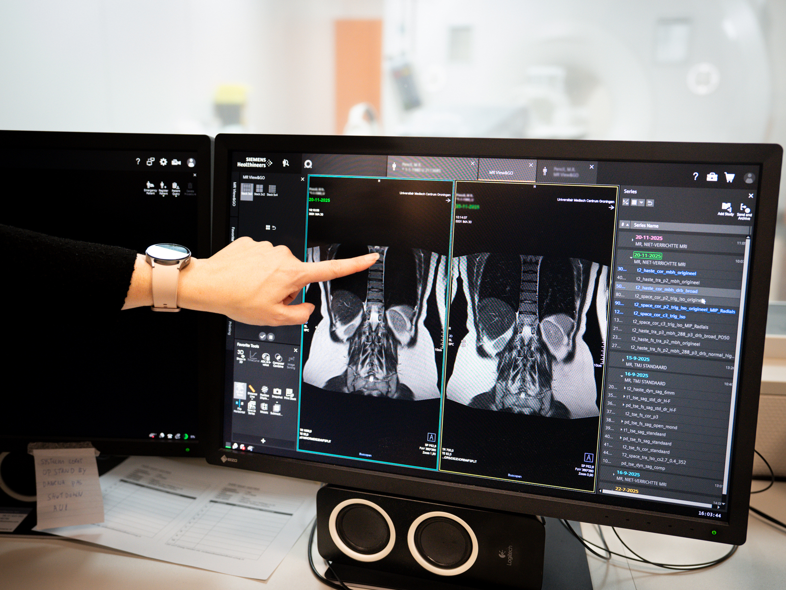 Diagnoses sneller en nauwkeuriger met nieuwe MRI-scanner